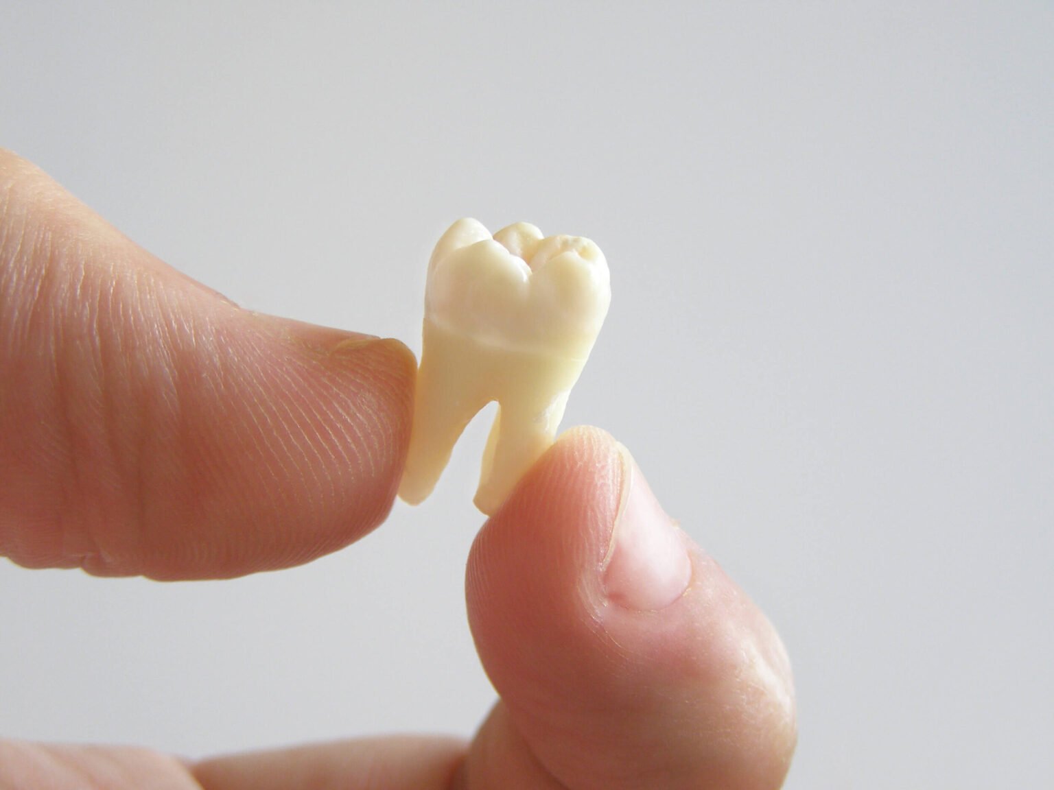 Dreaming of Teeth Falling Out in Islam - What It Really Means - Sakeena ...